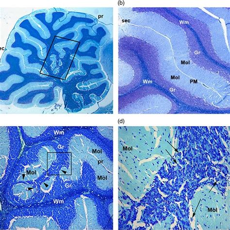 Sagittal Section Of A Cerebellum Showing Fusion And Ectopic Granular Download Scientific