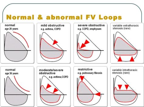 Pulmonary Function Testing