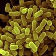 Lactobacillus Plantarum Photograph By Science Photo Library Fine Art