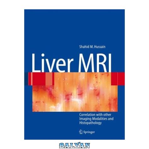 دانلود کتاب Liver Mri Correlation With Other Imaging Modalities And Histopathology بلیان