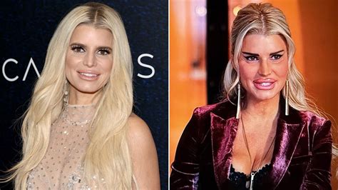 Jessica Simpson Reveals How Long Her Alls Fair Prosthetics