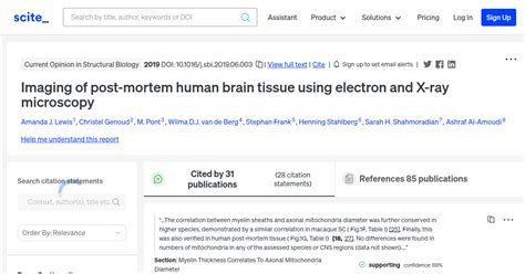 Imaging Of Post Mortem Human Brain Tissue Using Electron And X Ray Microscopy [scite Report]