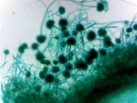 Fungi Microscope Slides At Nick Lopez Blog