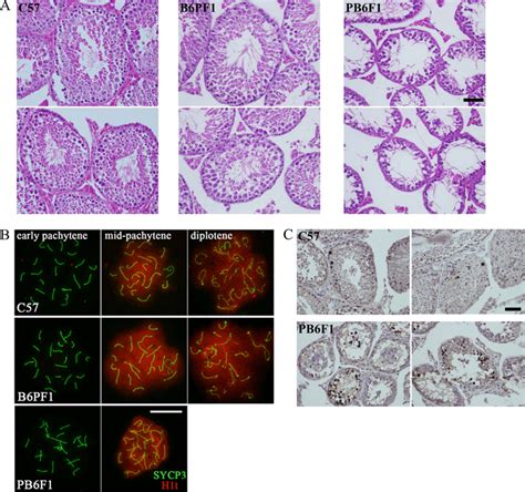 Block Of Spermatogenesis And Apoptosis Of Mid Pachytene Spermatocytes Download Scientific