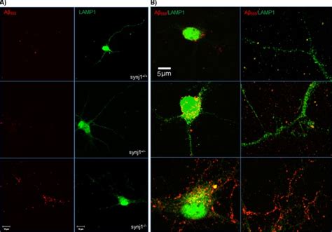 Reduction Of Synaptojanin 1 Accelerates Aβ Clearance And Attenuates Cognitive Deterioration In