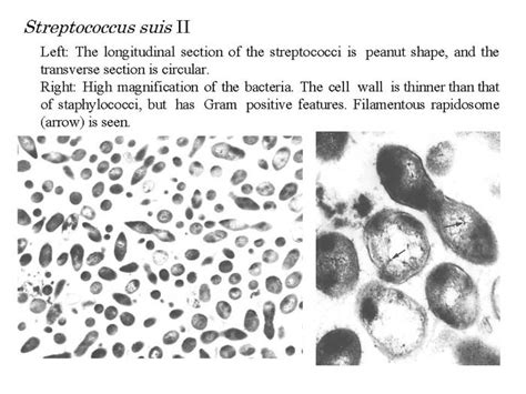 Streptococcus Under Microscope