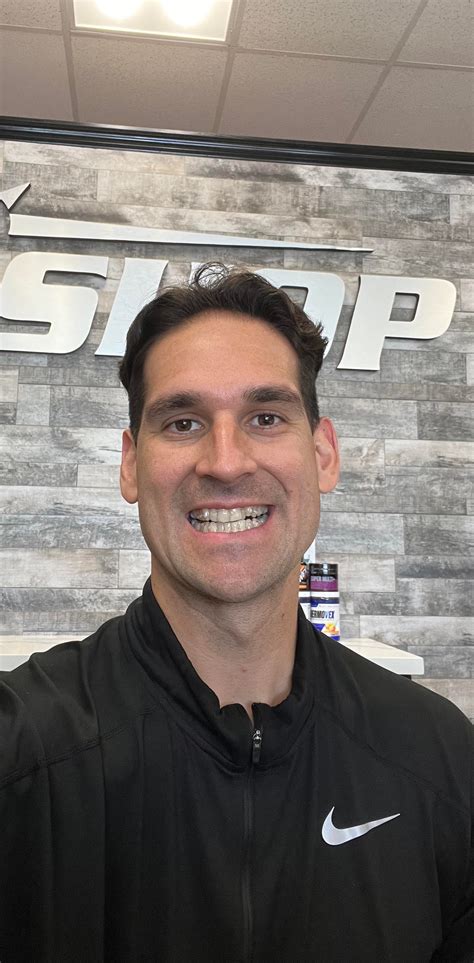 6 Month Progress Today Rinvisalign