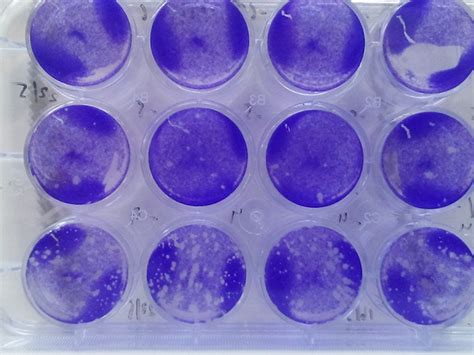 Plaque Assay Steps At Francine Rice Blog
