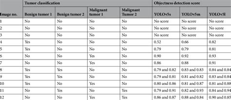 Overall Comparison Of Tumor Detection And Classification With Download Scientific Diagram