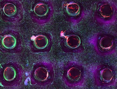 3d Bioprinting Of Living Tissues