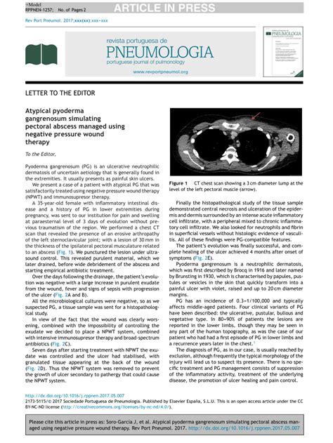 Pdf Atypical Pyoderma Gangrenosum Simulating Pectoral Abscess Managed