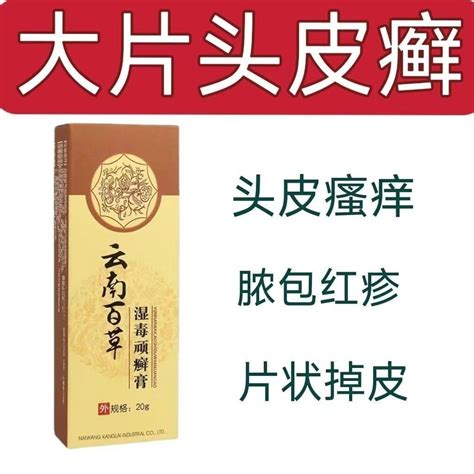 Scalp Ringworm Dandruff Acne Pustules Red Rash Itchy Sk Scalp Dandruff Acne Pseudo Acne