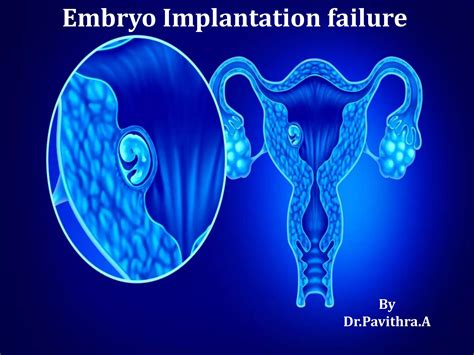 Embryo Implantation Failurepptx