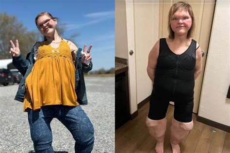 1000 Lb Sisters Star Tammy Slaton Is Unrecognizable In New Photos