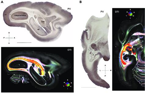 Parvalbumin Pv Stained Area Corresponds Well With Optic Radiation
