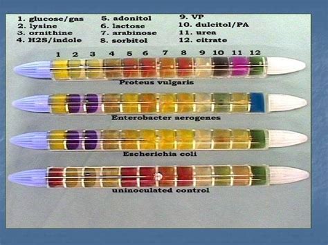 Enterotube Scheda Microbiologica Di Approfondimento