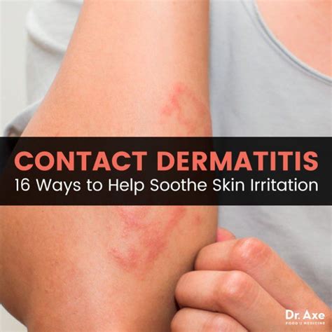 Contact Dermatitis Causes Natural Treatments Artofit