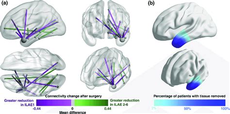 Features Derived With The Elastic Net Algorithm A Fifteen Features