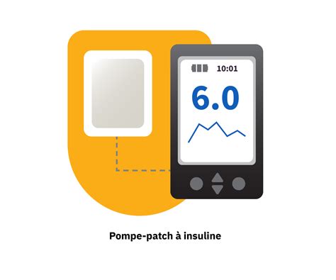 Thérapie Par Pompe à Insuline Simplifiée En Savoir Plus