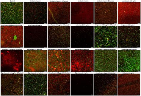 Staphylococcus Aureus Biofilms Viability Visualized By Live Dead