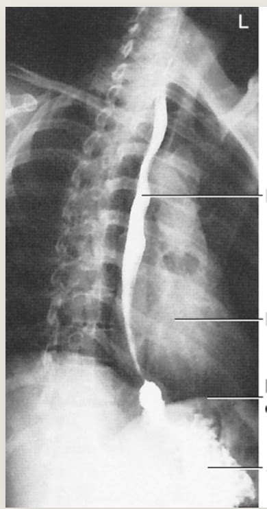 Fluoroscopy Diagram Quizlet