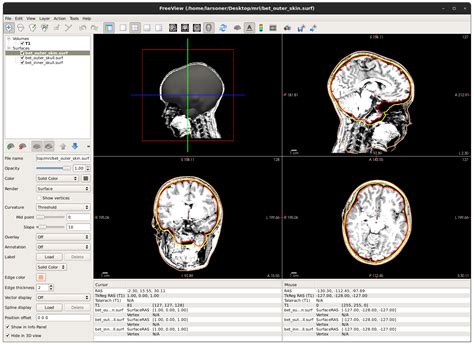 Enh Use Something Other Than Freesurfer For Bem Extraction · Issue 7232 · Mne Toolsmne Python