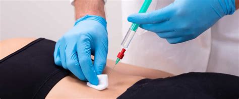 What Comes After Facet Joint Injections