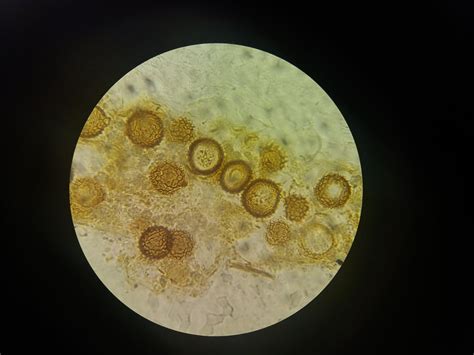 Albugo Candida X100 Mag Microscopy