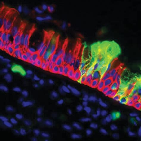 Measles Virus Under Microscope