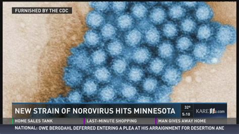 Norovirus Outbreaks On The Rise In Minnesota