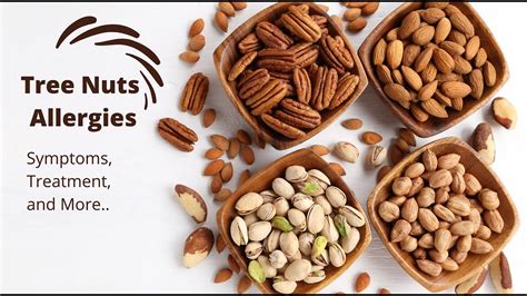 Tree Nut Allergy And Coconut At Donna Lahti Blog