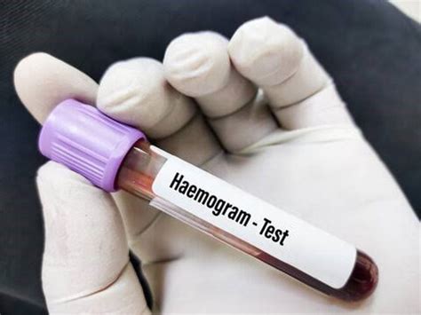 Why Is A Hemogram Test Prescribed