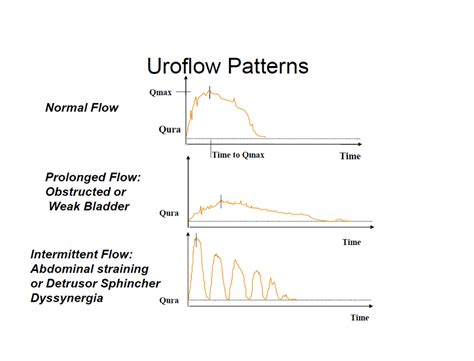 What Is Urine Flow Rate Test At Aaron Roberson Blog