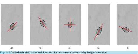 Figure 1 From Occlusion Robust Low Contrast Sperm Tracking Using