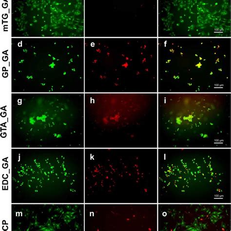 Live Dead Fluorescence Staining On Various Hydrogels In 2d Culture