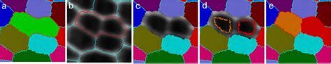 examples of under segmented cells a an under segmented cell outlined