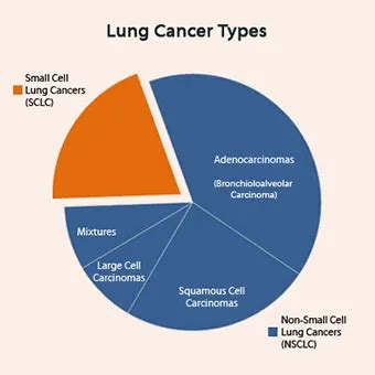 Most Common Types Of Lung Cancer CancerWalls