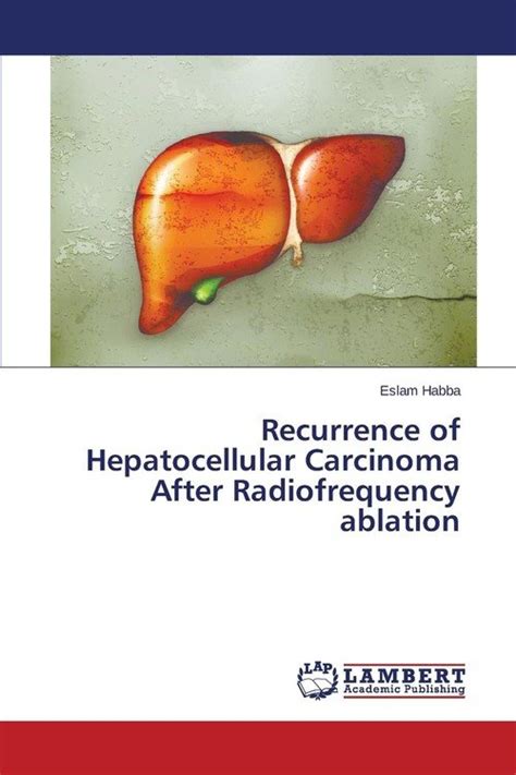 Recurrence Of Hepatocellular Carcinoma After Radiofrequency Ablation Habba Eslam Książka W Empik