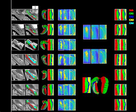 surface based subfield alignment pipeline a each 3d dataset manually