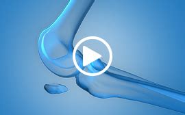 Online Appointment Dr Ross Burge Orthopedic Hip Surgeon Ventura Ca
