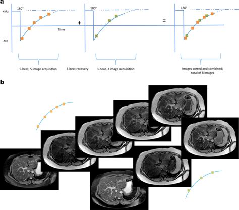 T1 Mapping A Acquisition Strategy For The Modified Look Locker Download Scientific Diagram