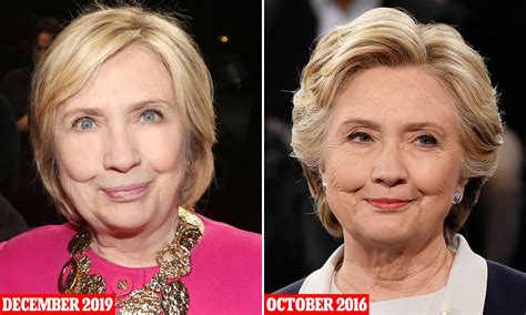 Hillary Clinton Plastic Surgery Before After