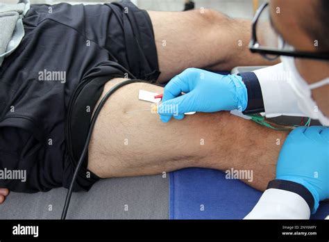 Electromyography Emg And Somatosensory Evoked Potential Pev Of Lower Extremities