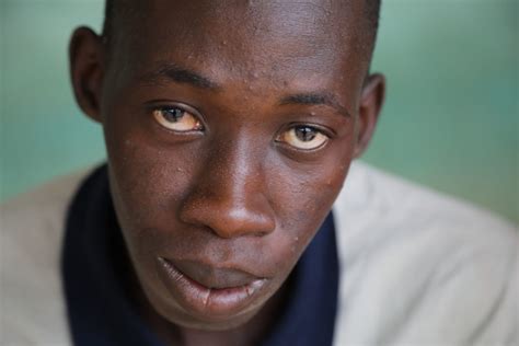 Ousmane Undiagnosedinternational