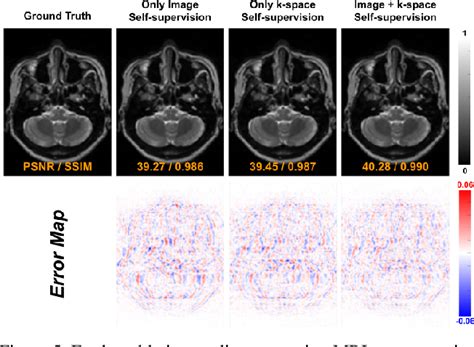 Figure 1 From Dsformer A Dual Domain Self Supervised Transformer For
