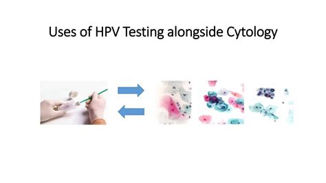 Uses Of Hpv Testing In Triage Of Cervical Screening Ppt