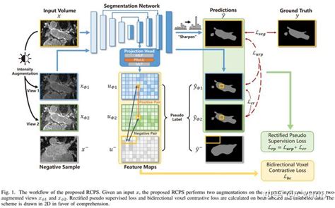 半监督医学图像分割方法新sota 校正对比伪监督学习 知乎
