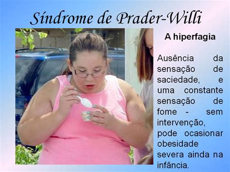 Educação Especial Do Agrupamento De Escolas Fernando Namora Síndrome