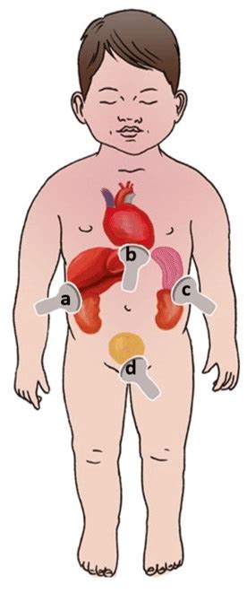 Fast Views A Perihepatic B Sub Xiphoid C Perisplenic D Pelvic