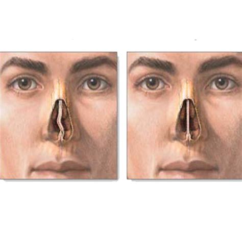 სასუნთქი სისტემა და On Emaze